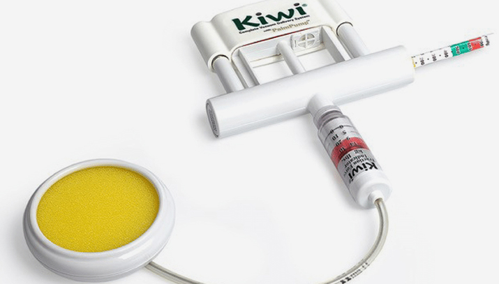 Kiwi Obstetric Vacuum Delivery System | Synecco