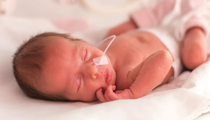 Neonatal Feeding & Medication Delivery Systems | Synecco